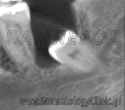 Archives | StomatologyClinic.gr